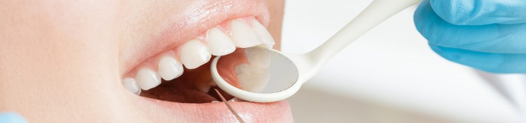 3 TIPS VOOR EEN SUPER GEZOND GEBIT